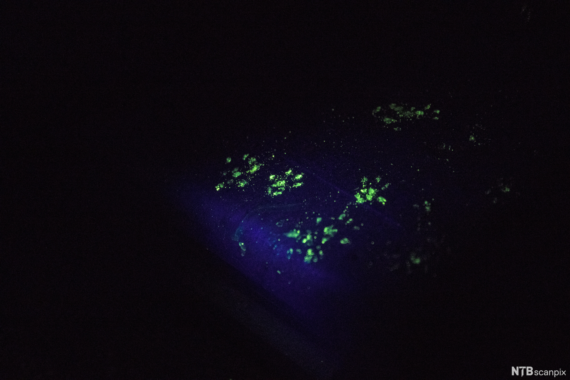 Utforsk smittekjeden - Biologi 1 - NDLA