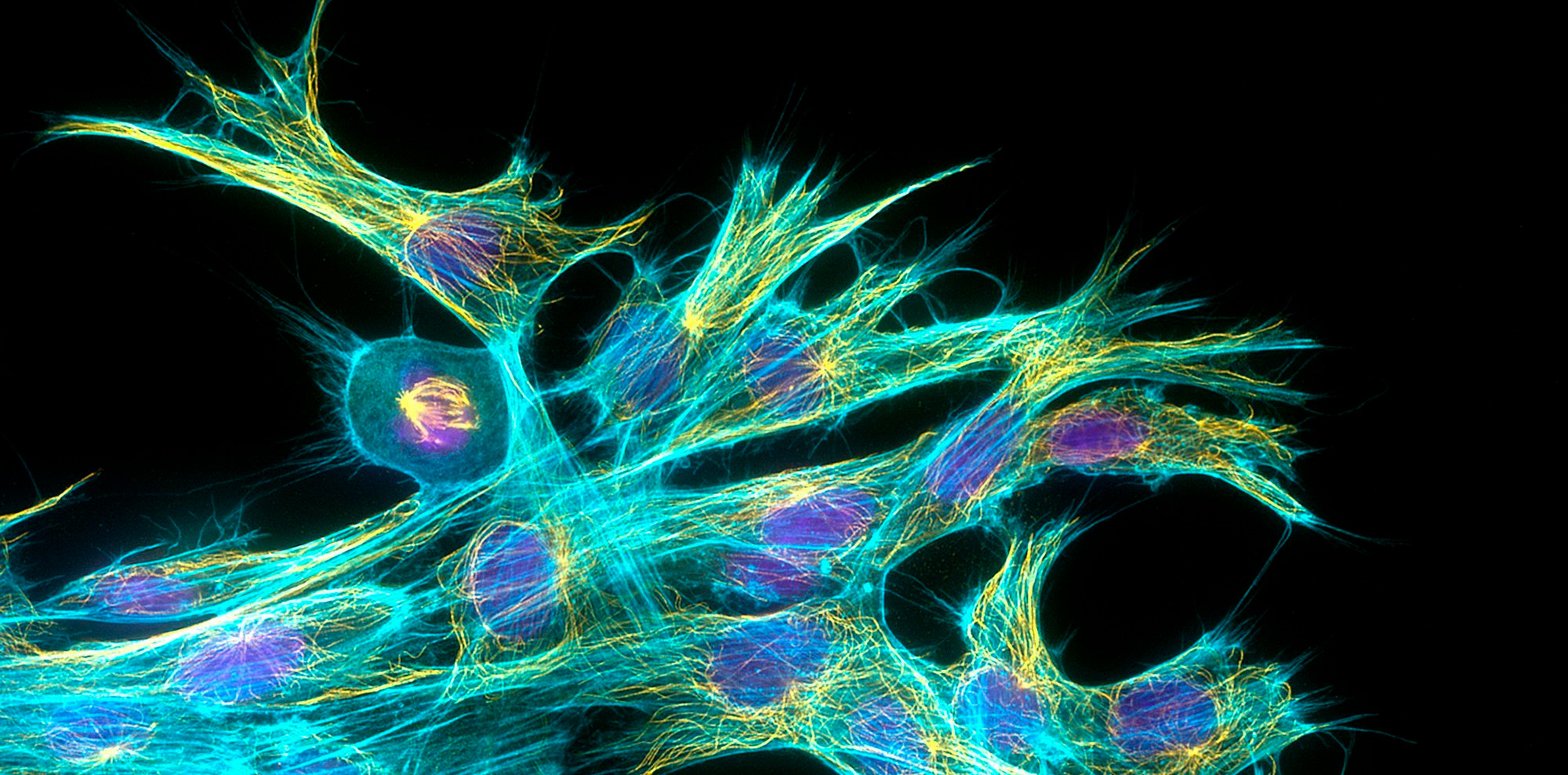 Cytosol og cytoskjelettet - Biologi 1 - NDLA