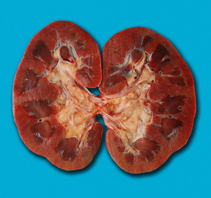 Nyrer og urinveier - Helsefremmende arbeid (HS-HSF vg1) - NDLA