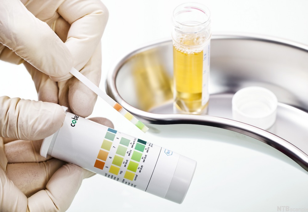 Urin – regulering, urinering og diagnostikk - Biologi 1 - NDLA